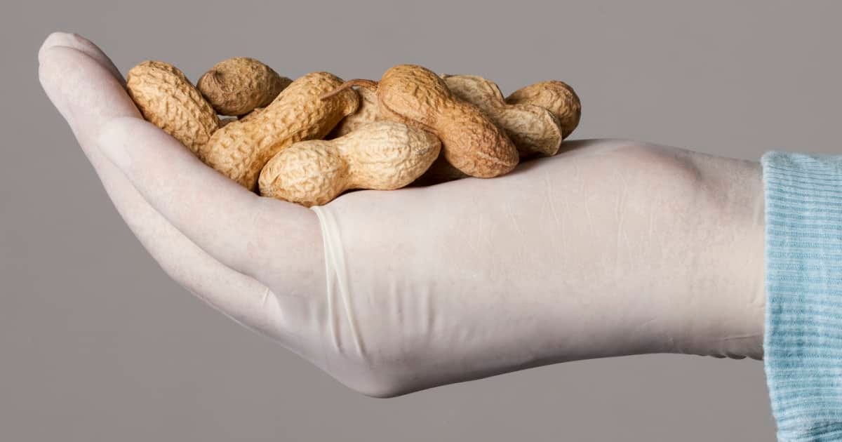Do you have a mild food allergy?